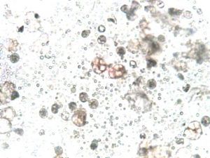 Slug poo and toadstools