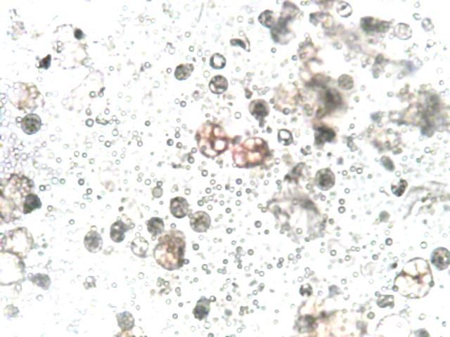 Slug poo and toadstools